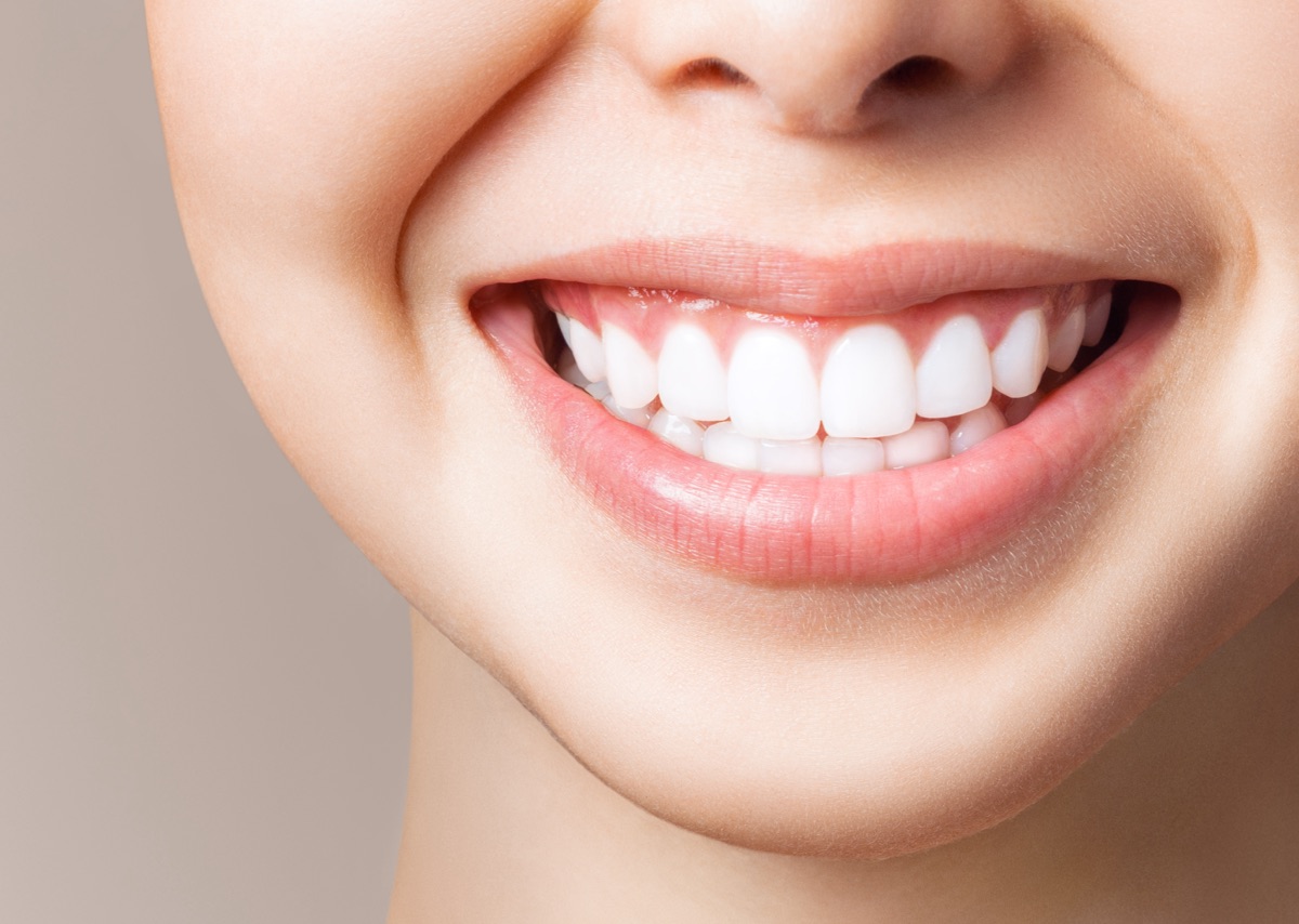 Gummy smile - Dott. Guerra